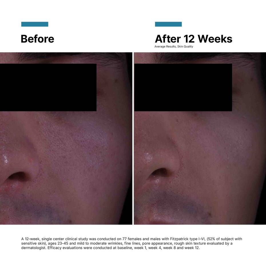 P-TIOX Anti-Wrinkle Cream | SkinCeuticals