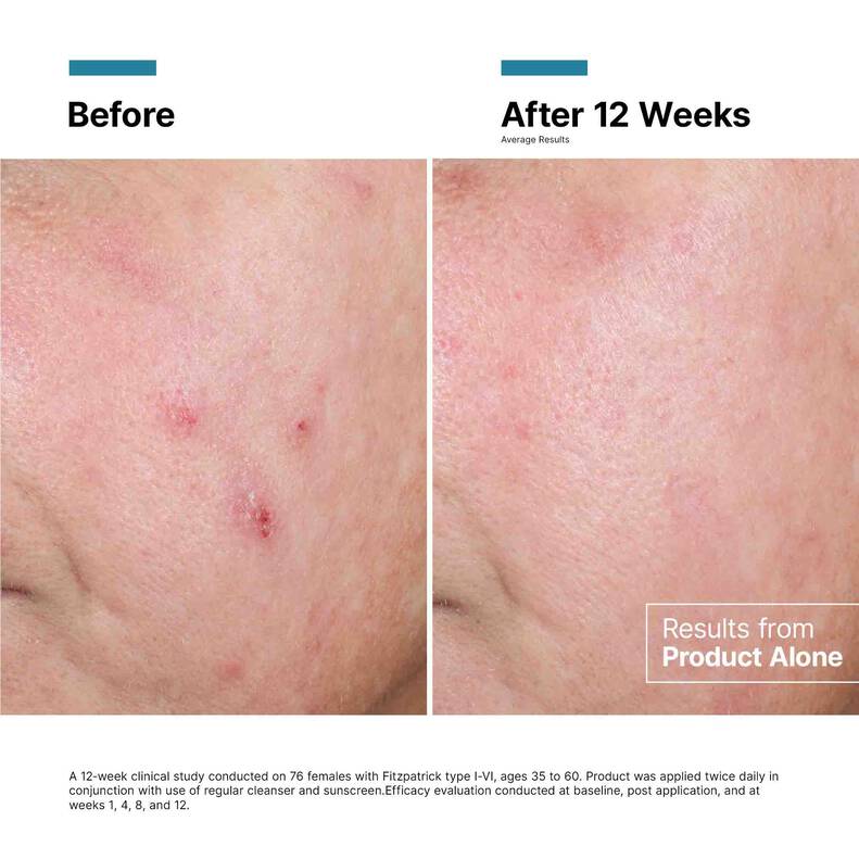 Advanced RGN-6 Skin Rejuvenation and Repair Cream | SkinCeuticals