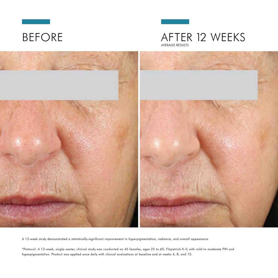 Daily Skin Brightening Sunscreen SPF 30 | SkinCeuticals
