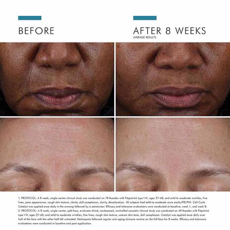 Cell Cycle Catalyst™ Anti-Aging Serum | SkinCeuticals