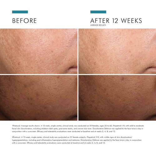 Discoloration Defense Serum for Dark Spots | SkinCeuticals