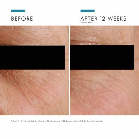 A.G.E Eye Complex: Eye Cream for Dark Circles & Wrinkles | SkinCeuticals