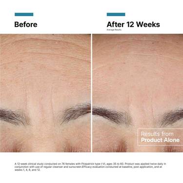 Advanced RGN-6 Skin Rejuvenation and Repair Cream | SkinCeuticals