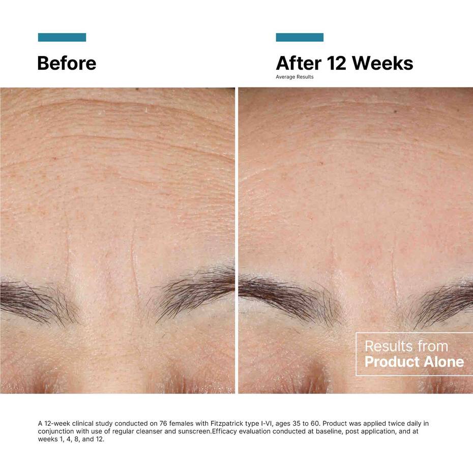 Advanced RGN-6 Skin Rejuvenation and Repair Cream | SkinCeuticals