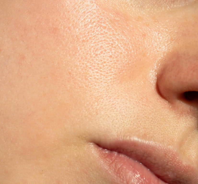 How to Minimize Pores with Skincare & Treatments | SkinCeuticals